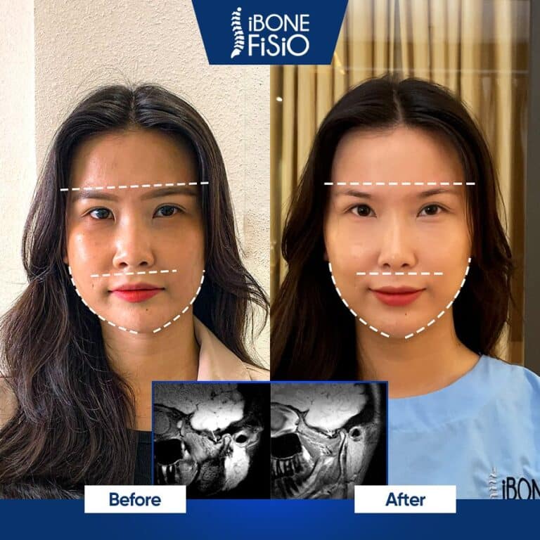 Cận cảnh hiệu quả cực đỉnh sau lần đầu thực hiện phương pháp điều trị ...