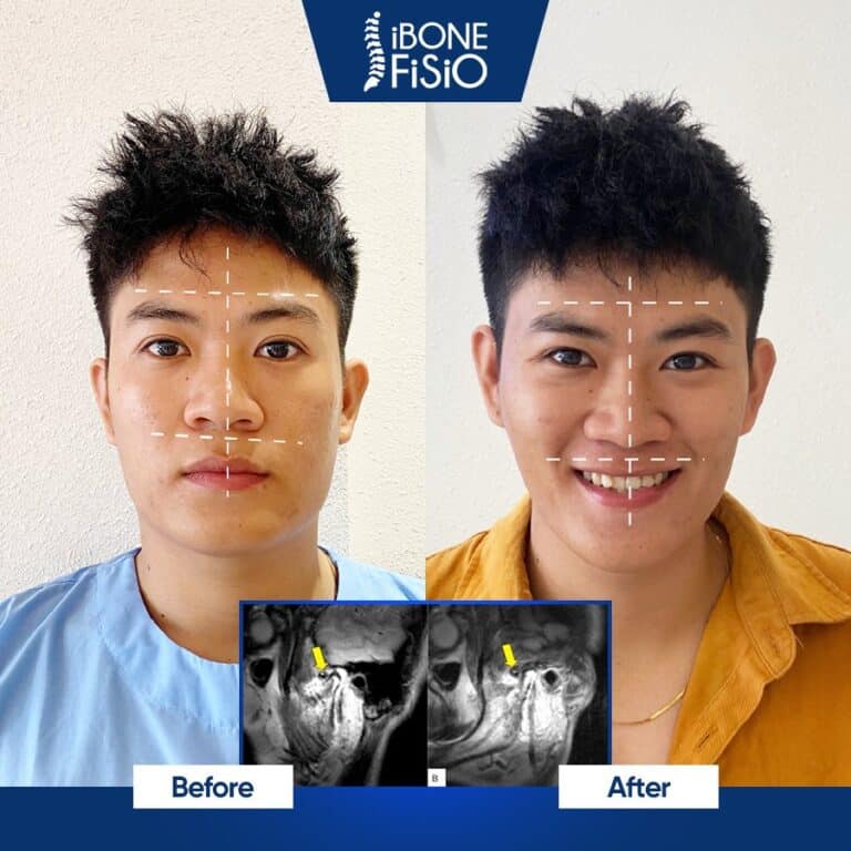 Cận cảnh hiệu quả cực đỉnh sau lần đầu thực hiện phương pháp điều trị ...